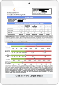 What Does The Autoimmune Brain Panel™ Measure?